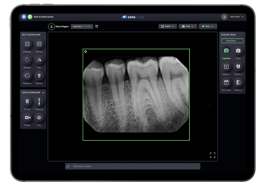 SOTA Cloud | Modern Dental Imaging Software Powered by AI